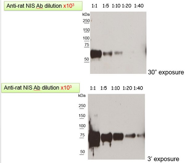 Anti-Sodium-Iodine Symporter (NIS) C-term | ABC1453